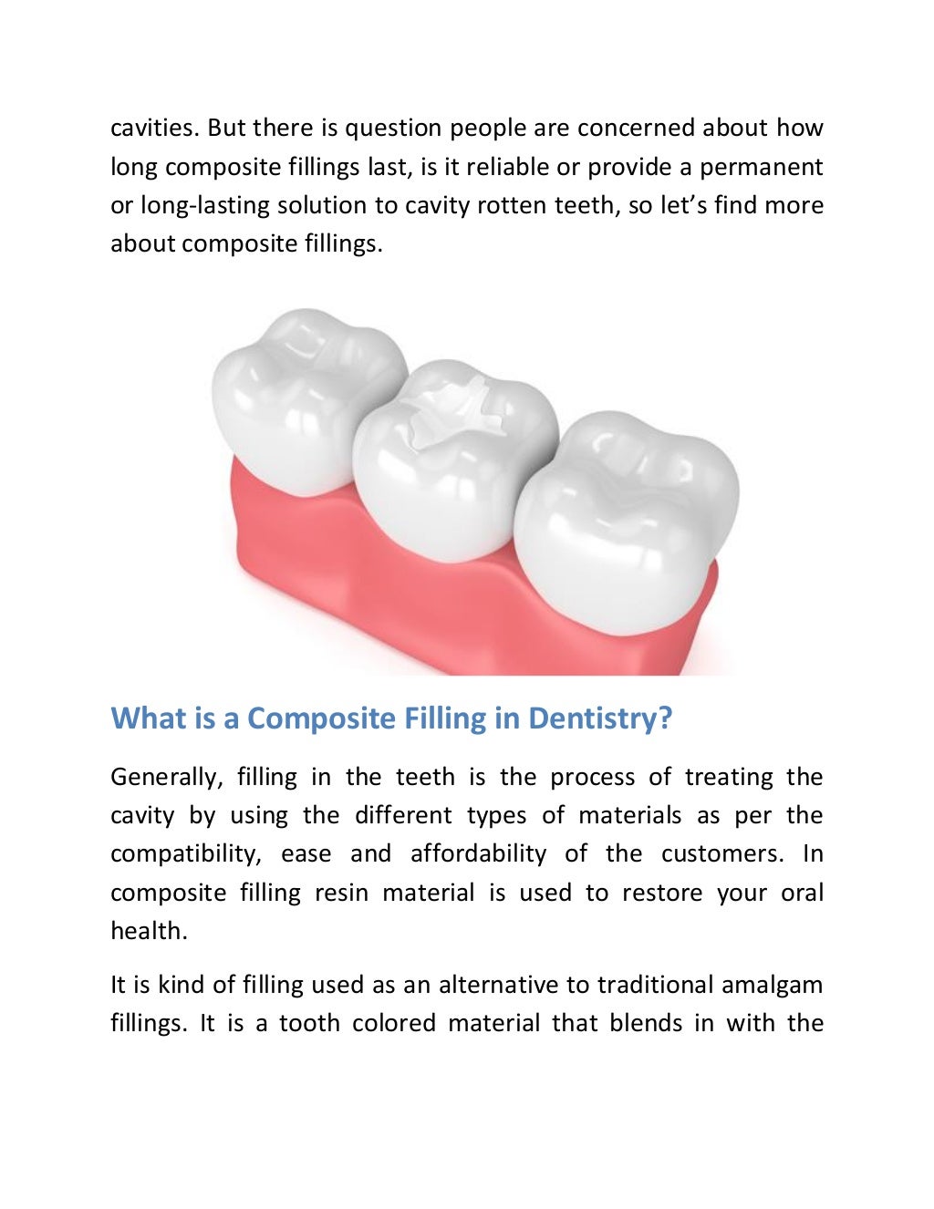 How Long Composite Fillings Last And Take Care Of It