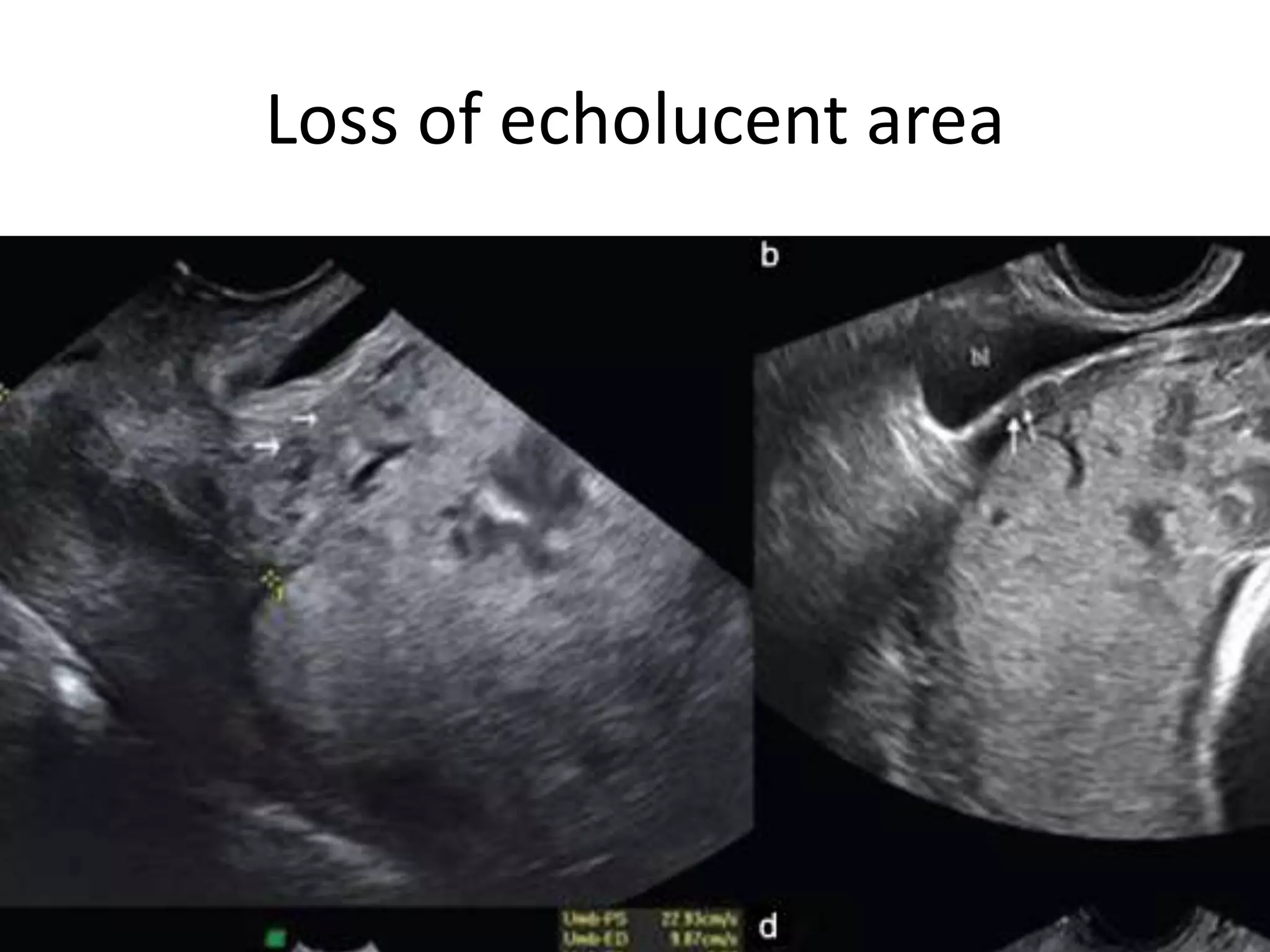 The placenta - odds and sods | PPTX
