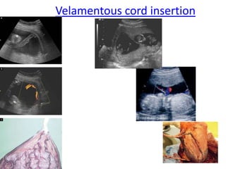 The placenta - odds and sods | PPT