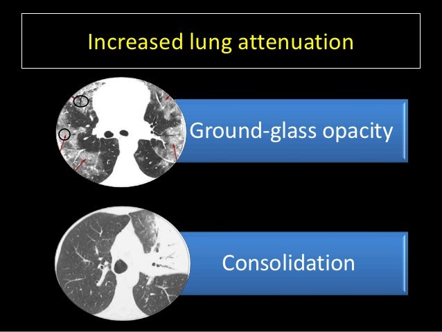 How read chest ct 2