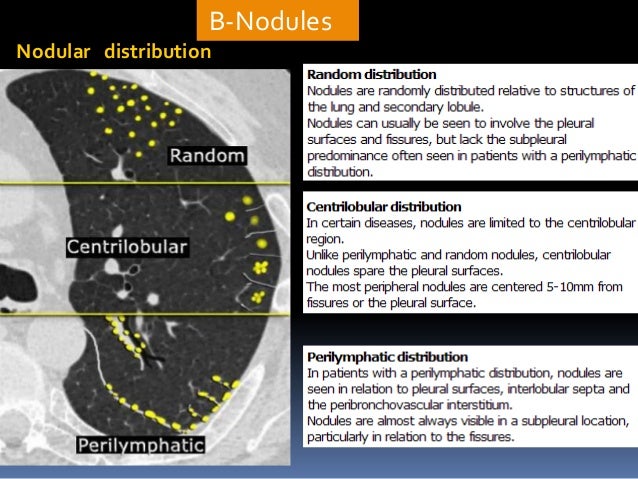 How read chest ct 3