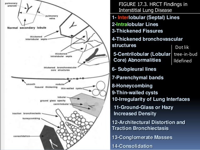 How read chest ct 3