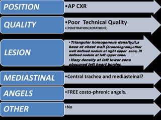 How read chest xr 4 | PPT