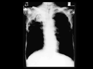 How read chest xr 4 | PPT