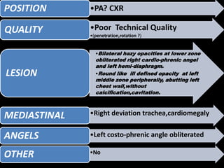 How read chest xr 7 | PPSX