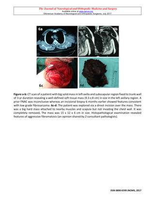 How satisfactory is management of sts | PDF