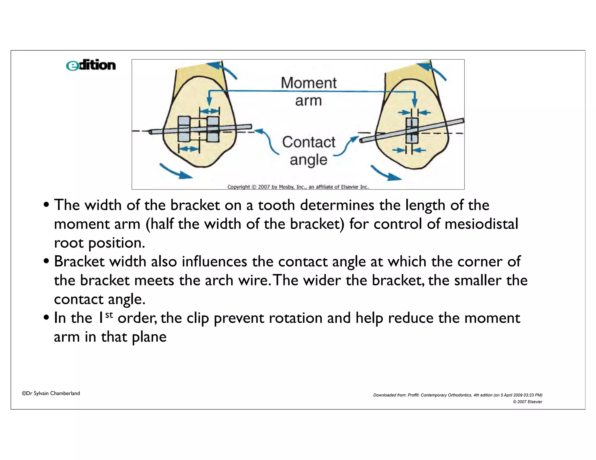 How SPEED Appliance is Effective in Torque Control, Space Closure and ...