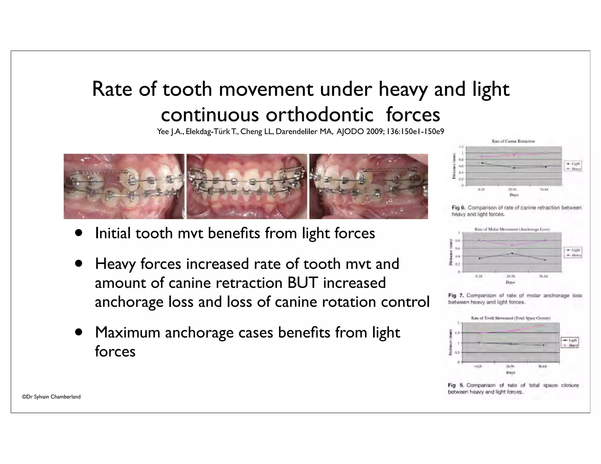 How SPEED Appliance is Effective in Torque Control, Space Closure and ...