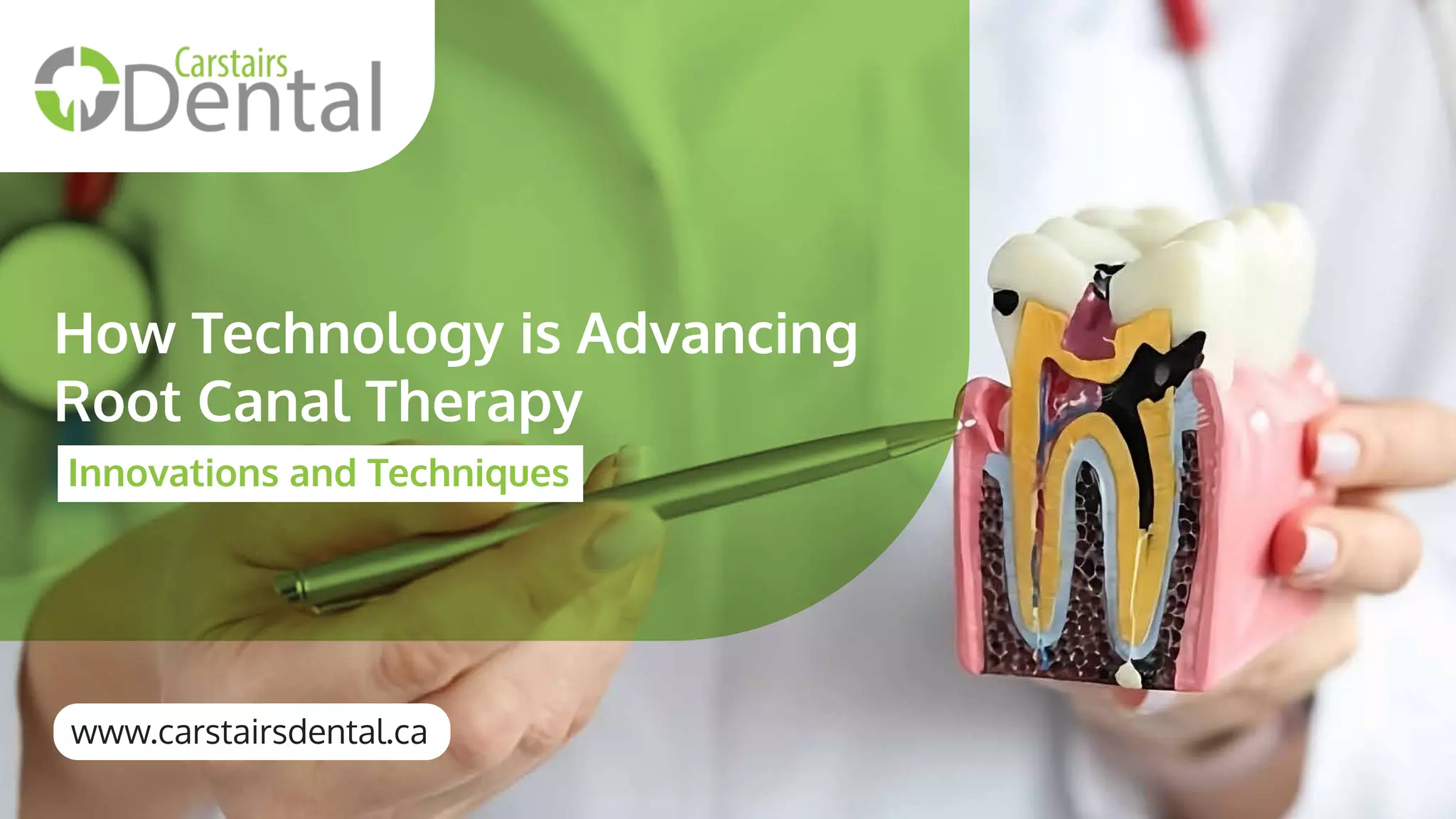 Advancements in Technology Transform Root Canal Therapy | PDF