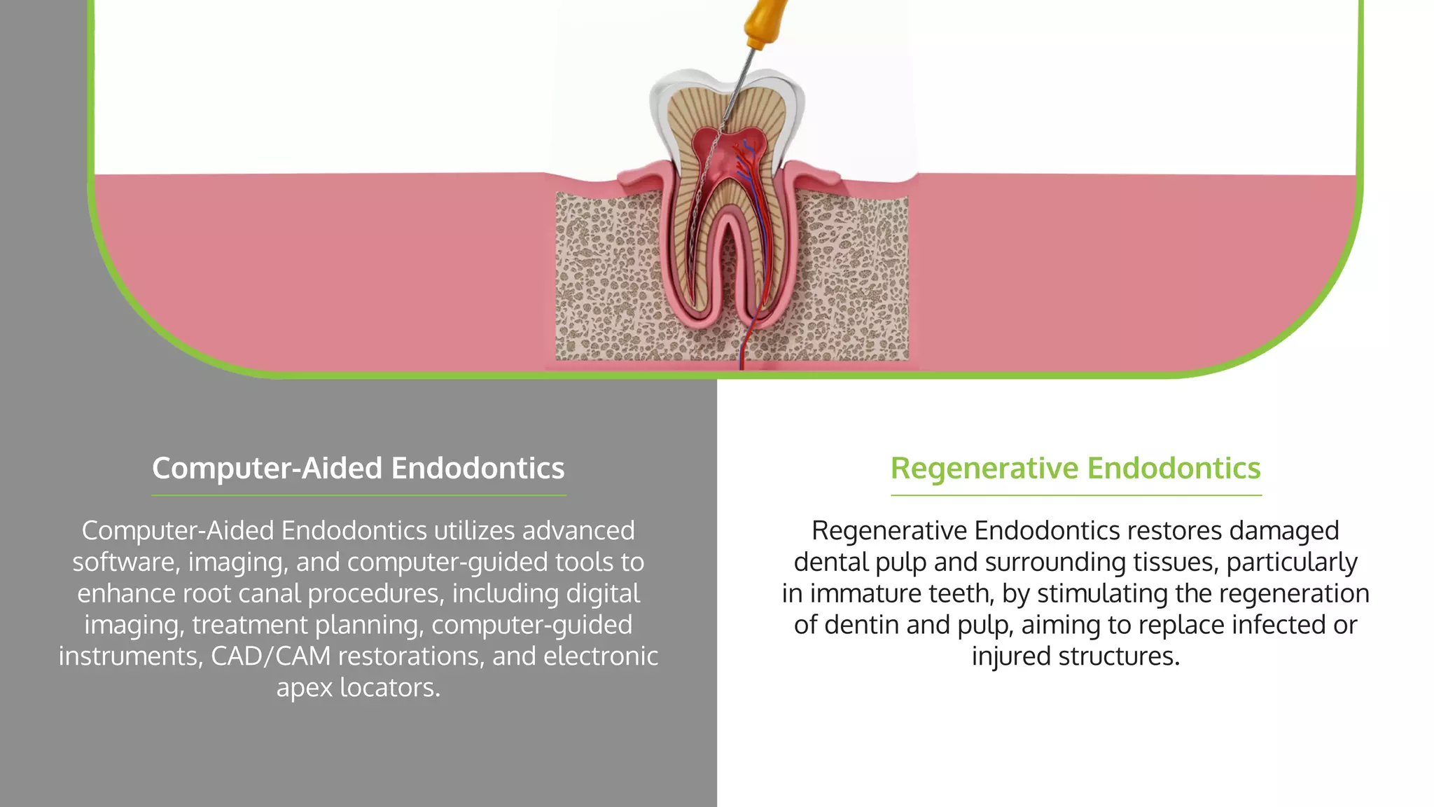Advancements in Technology Transform Root Canal Therapy | PDF