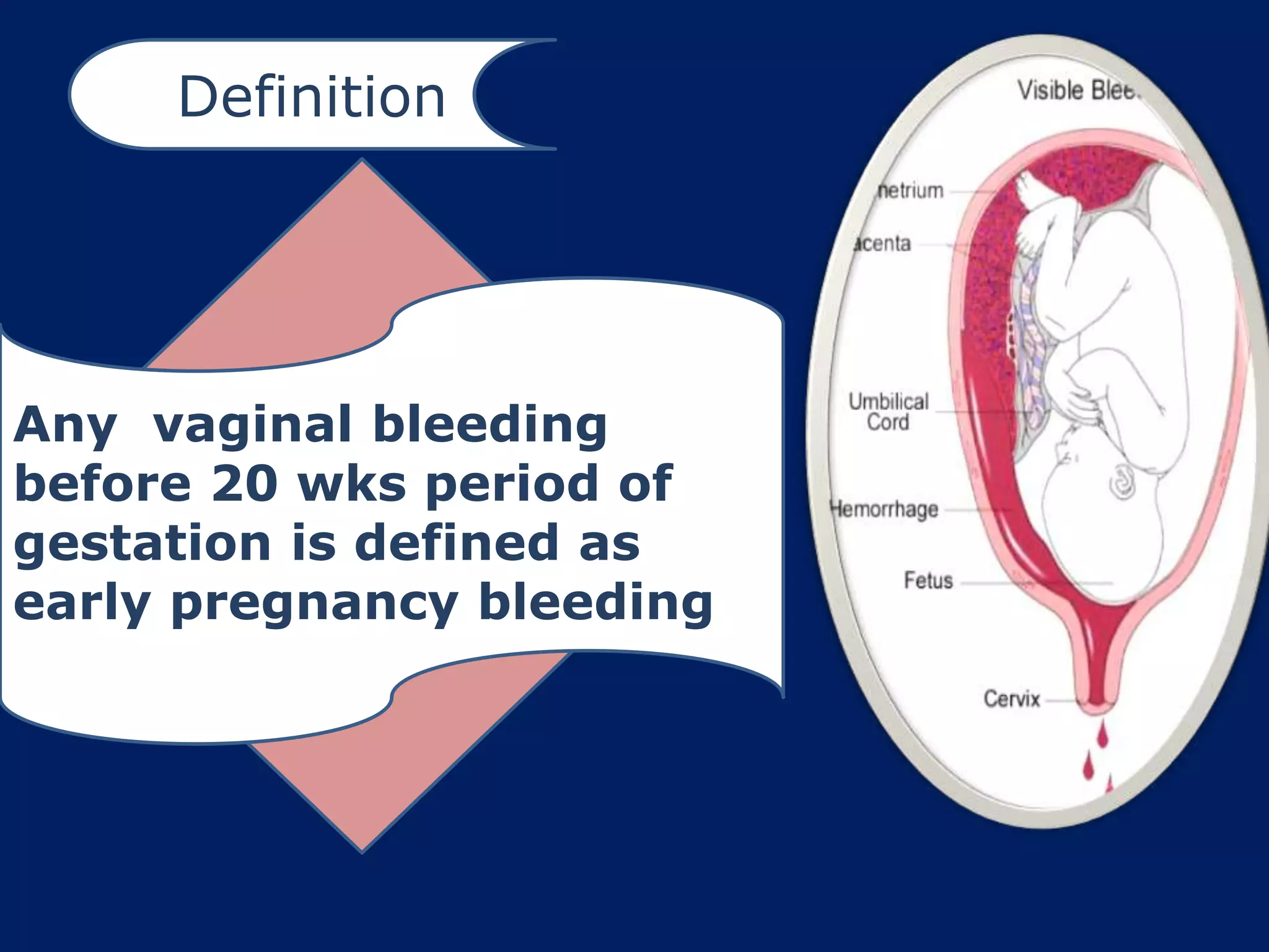 How to approch a case of bleeding in early pregnancy with case ...