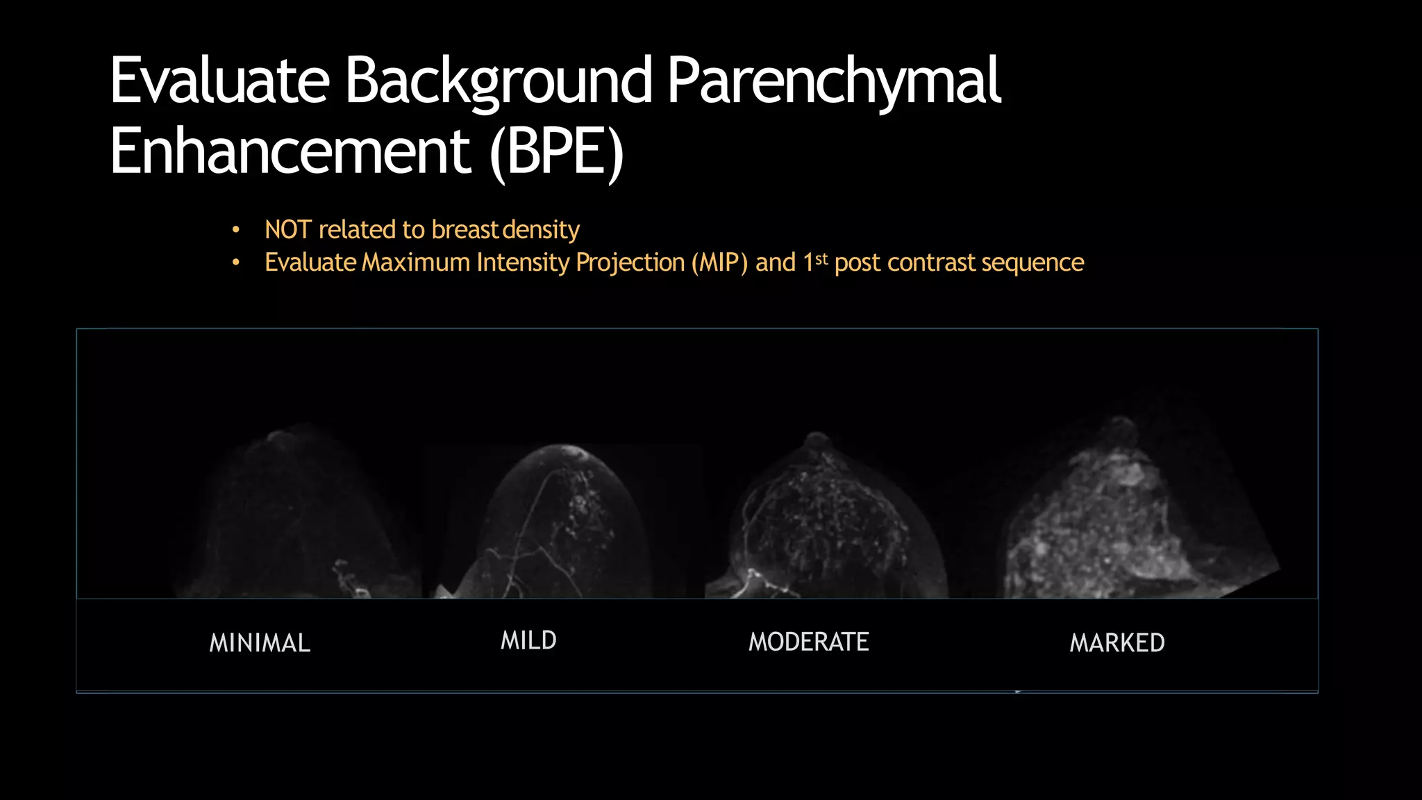 How to approch breast mri converted | PPTX