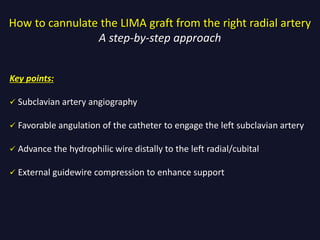 Bagur R - AIMRADIAL 2014 Technical - Cannulate the LIMA | PPTX
