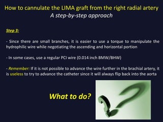 Bagur R - AIMRADIAL 2014 Technical - Cannulate the LIMA | PPTX