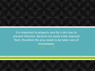 How to care for a skin tear | PPTX