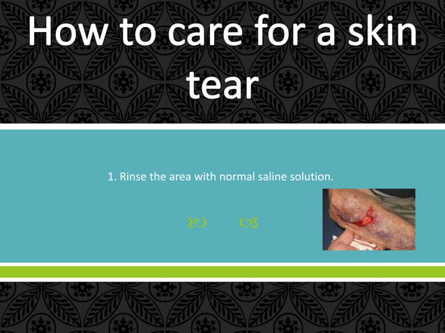 How to care for a skin tear | PPT