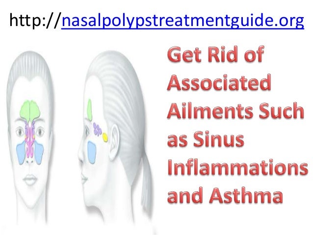 How to cope with allergic rhinitis nasal polyps with home remedies