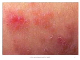 How to cope with tomcat bite | PPT