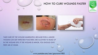 How To Cure Wounds Faster | PPTX