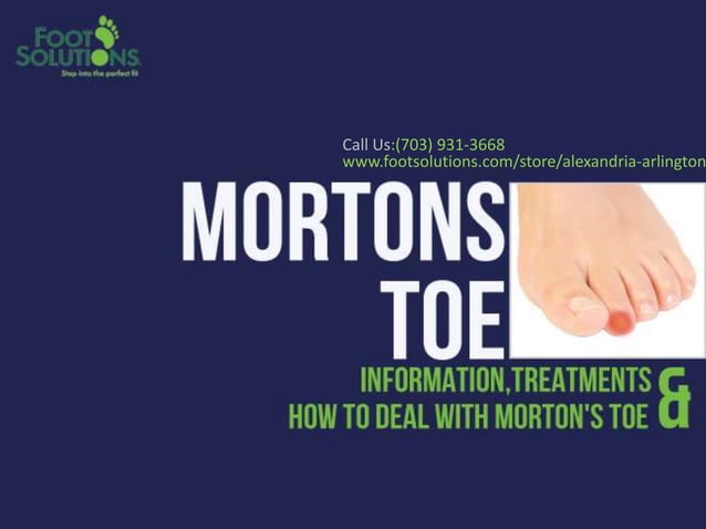 How to deal with morton toes | PPT