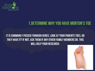 How to deal with morton toes | PPT