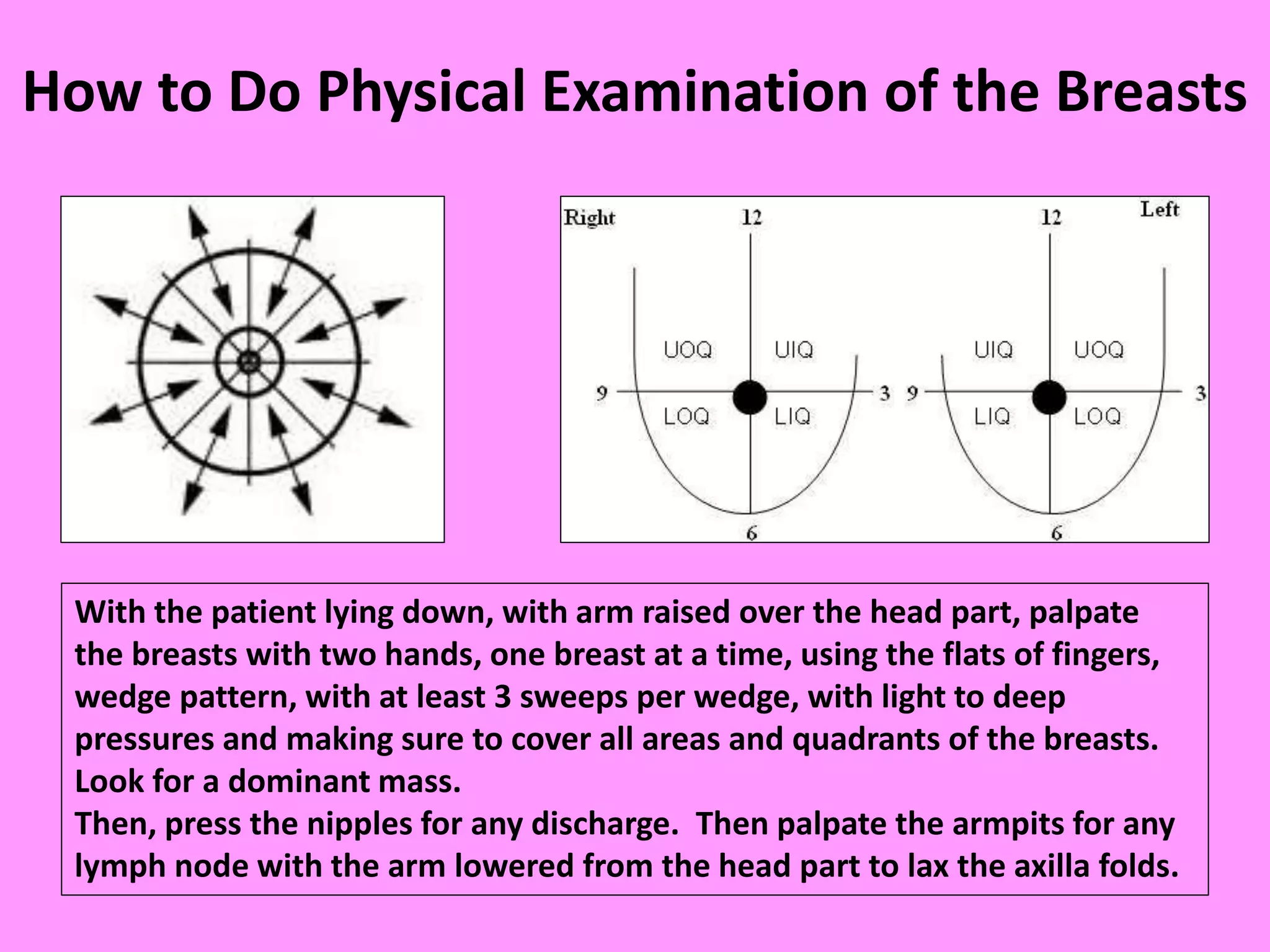 How to Do Physical Examination of the Breasts | PPTX