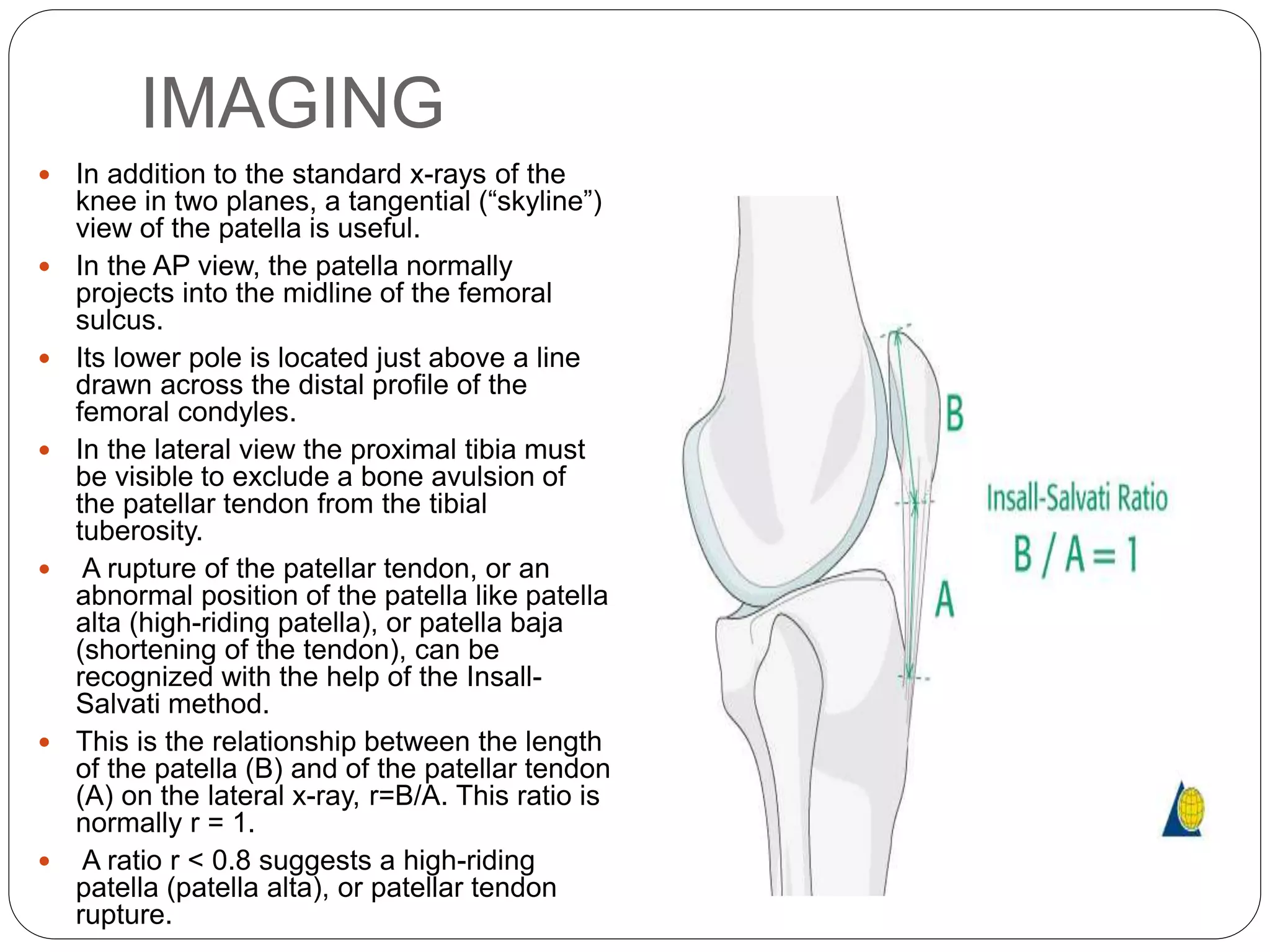 How to do tension band wire | PPTX