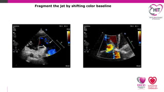 How to echo... tr.ppt