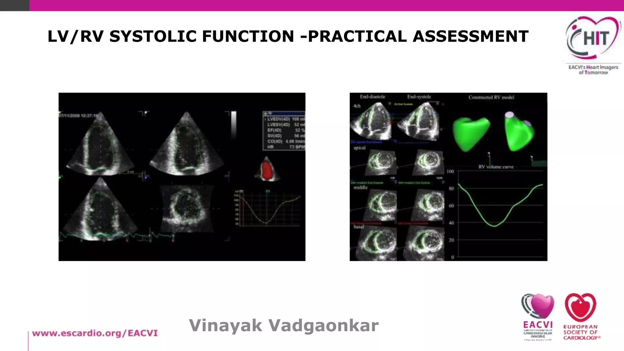 How to echo series...LV systolic function-practical assessment | PPT