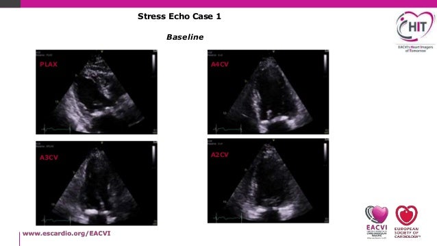 Echo Lv Function Assessment | Natural Resource Department