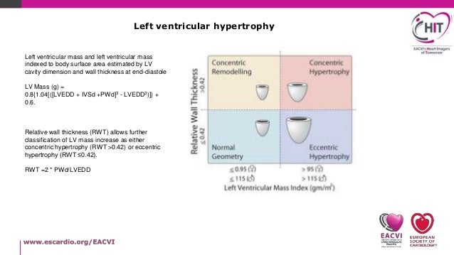 Echo Lv Function Assessment | Natural Resource Department
