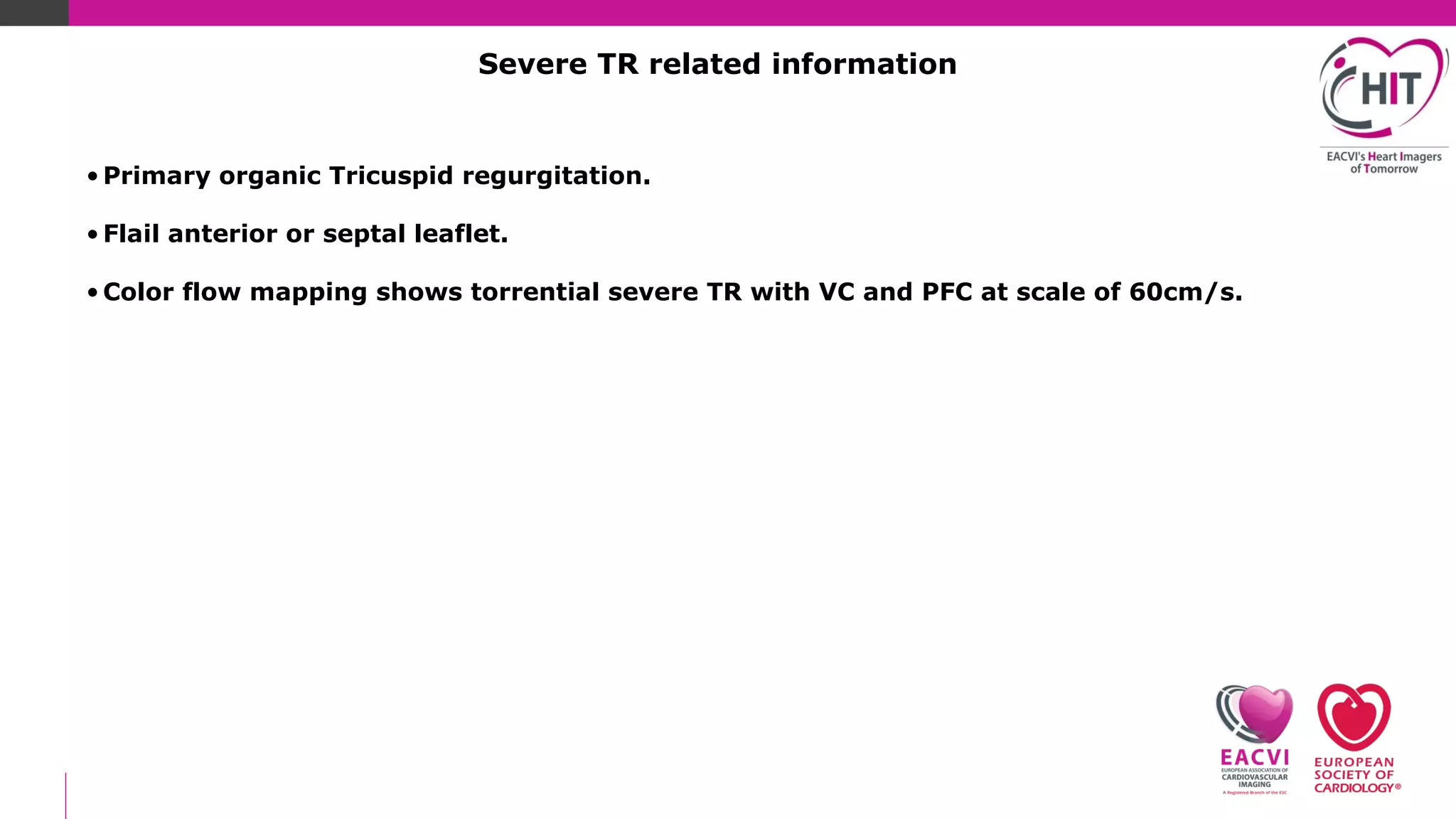 How to echo... tricuspid regurgitation.ppt