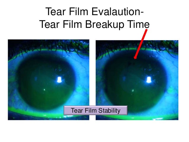 How to examine a corneal pathology-basics