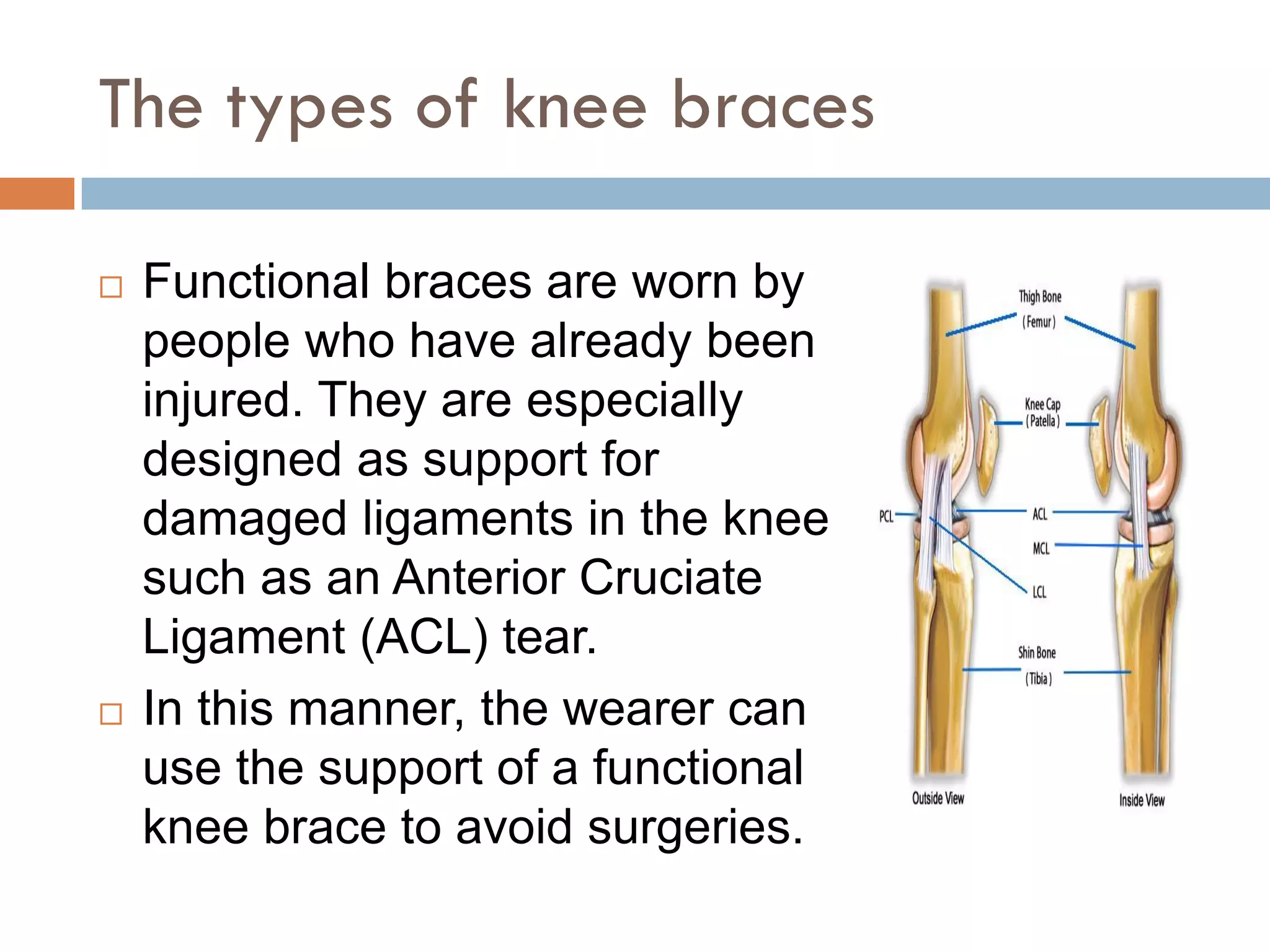 How to find the best knee brace | PDF