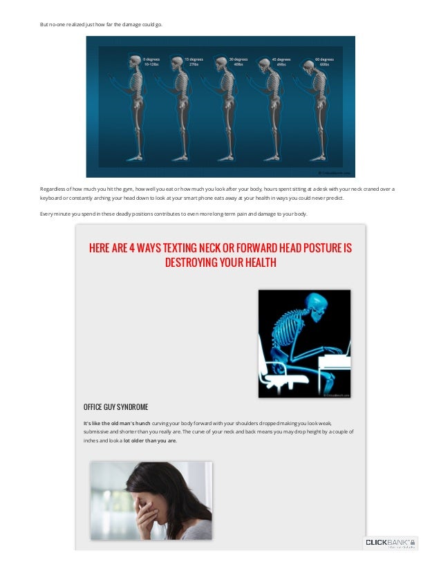 How To Fix Forward Head Posture: A complete Guide | PDF