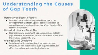 How to Fix Gap Teeth | PPTX