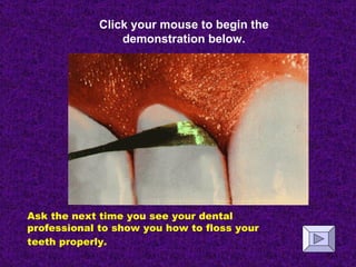 How to Use Dental Floss | PPT