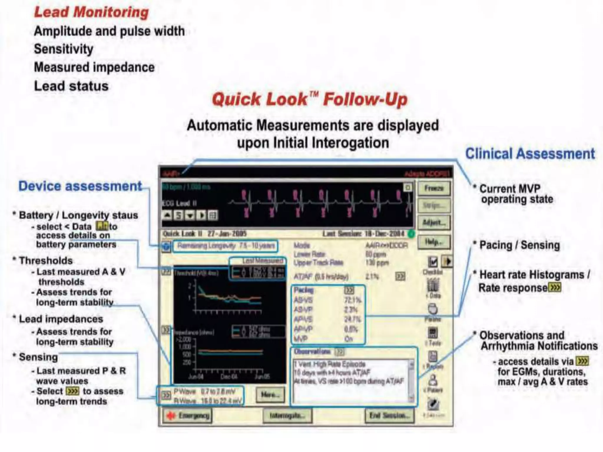 How to follow up a patient with a pacemaker | PPT