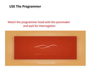 How to follow up a patient with a pacemaker | PPT