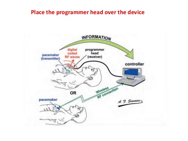 How to follow up a patient with a pacemaker