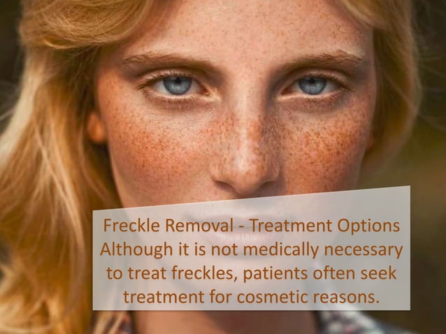 How to Get Rid of Freckles – Treatment Options for Freckle Removal | PPTX