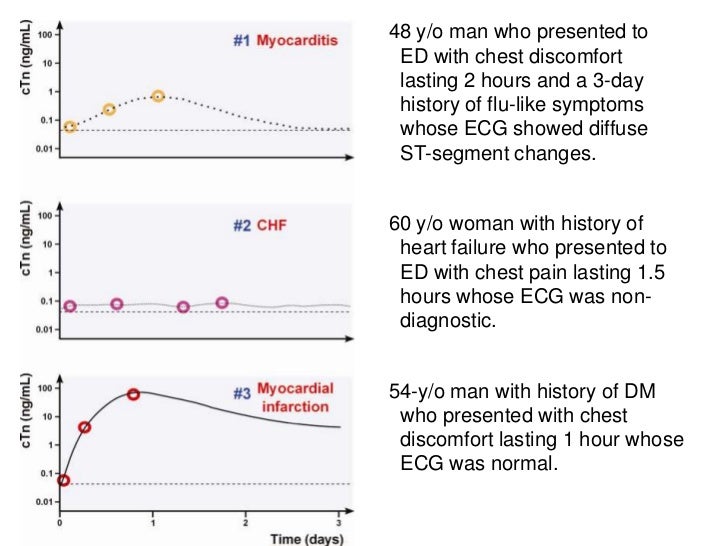How to Interpret Elevated Cardiac Troponin Levels
