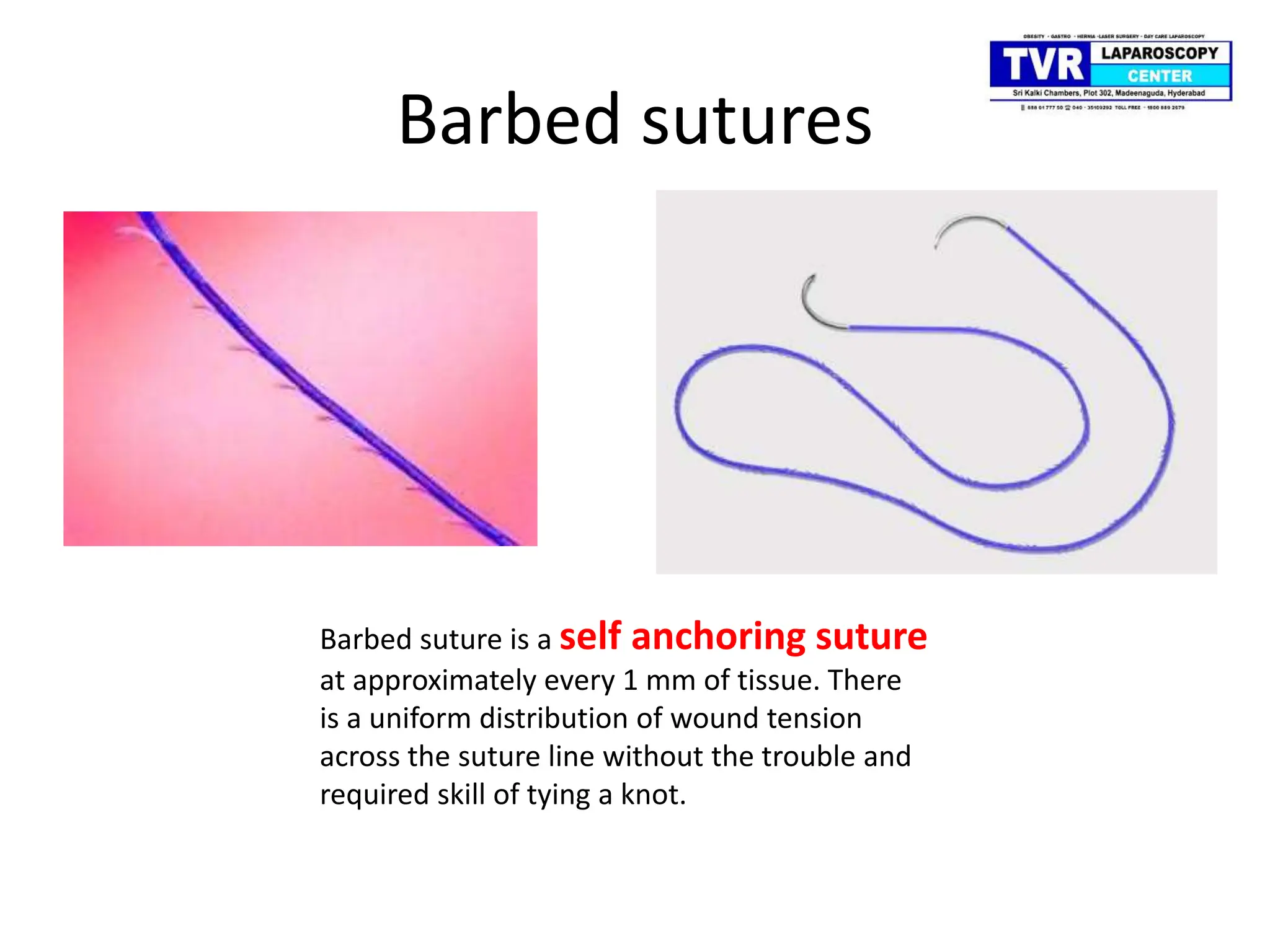 How to master in Laparoscopic SuturingDRTVR.pptx