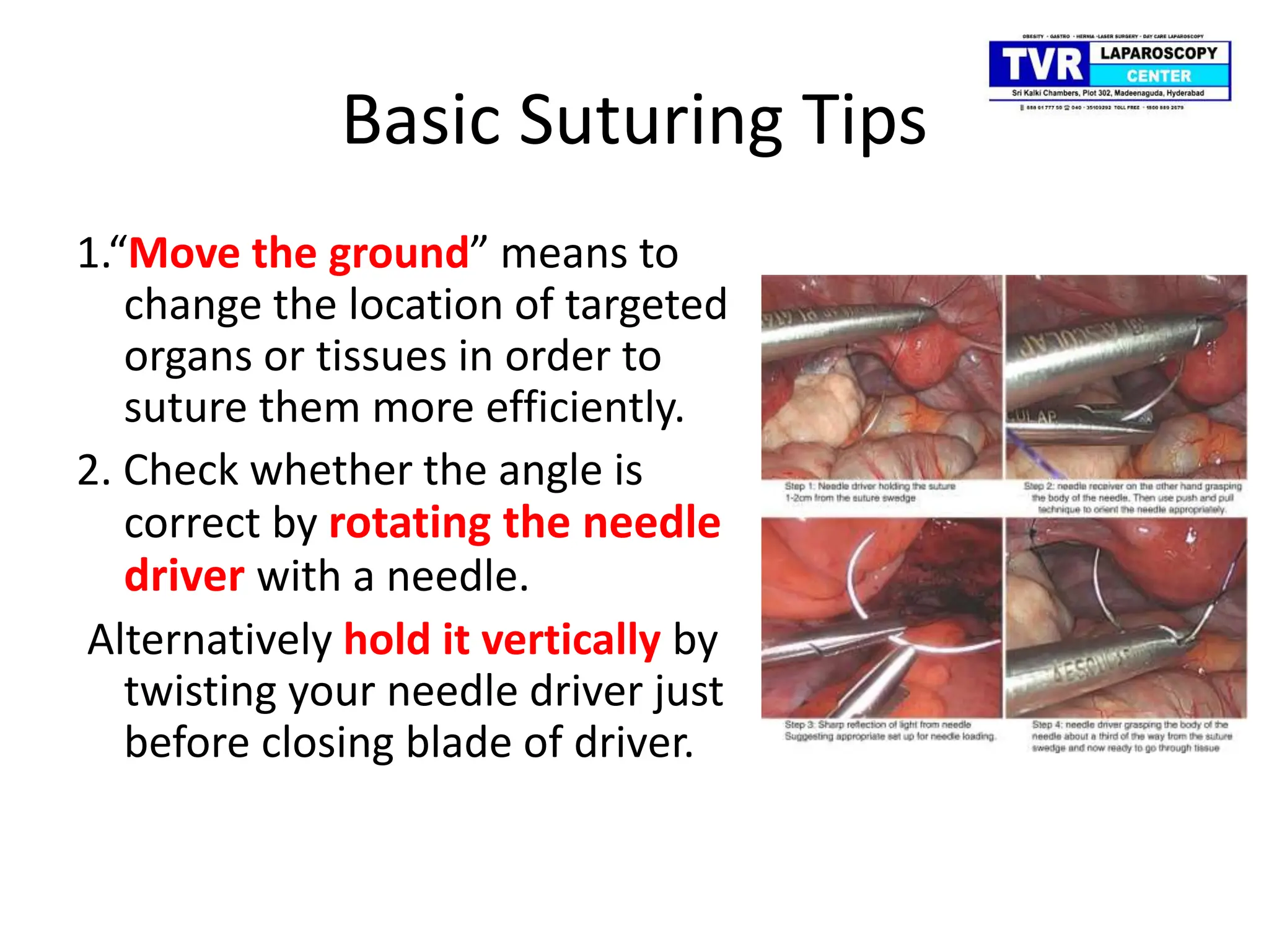 How to master in Laparoscopic SuturingDRTVR.pptx