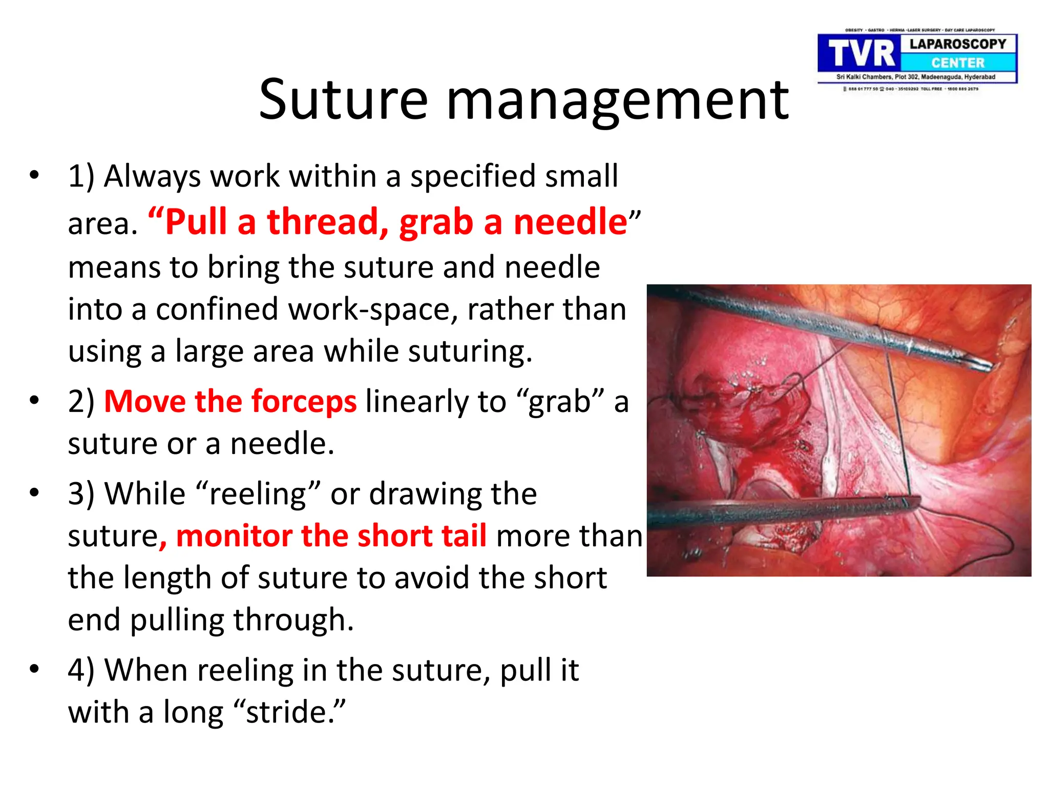 How to master in Laparoscopic SuturingDRTVR.pptx