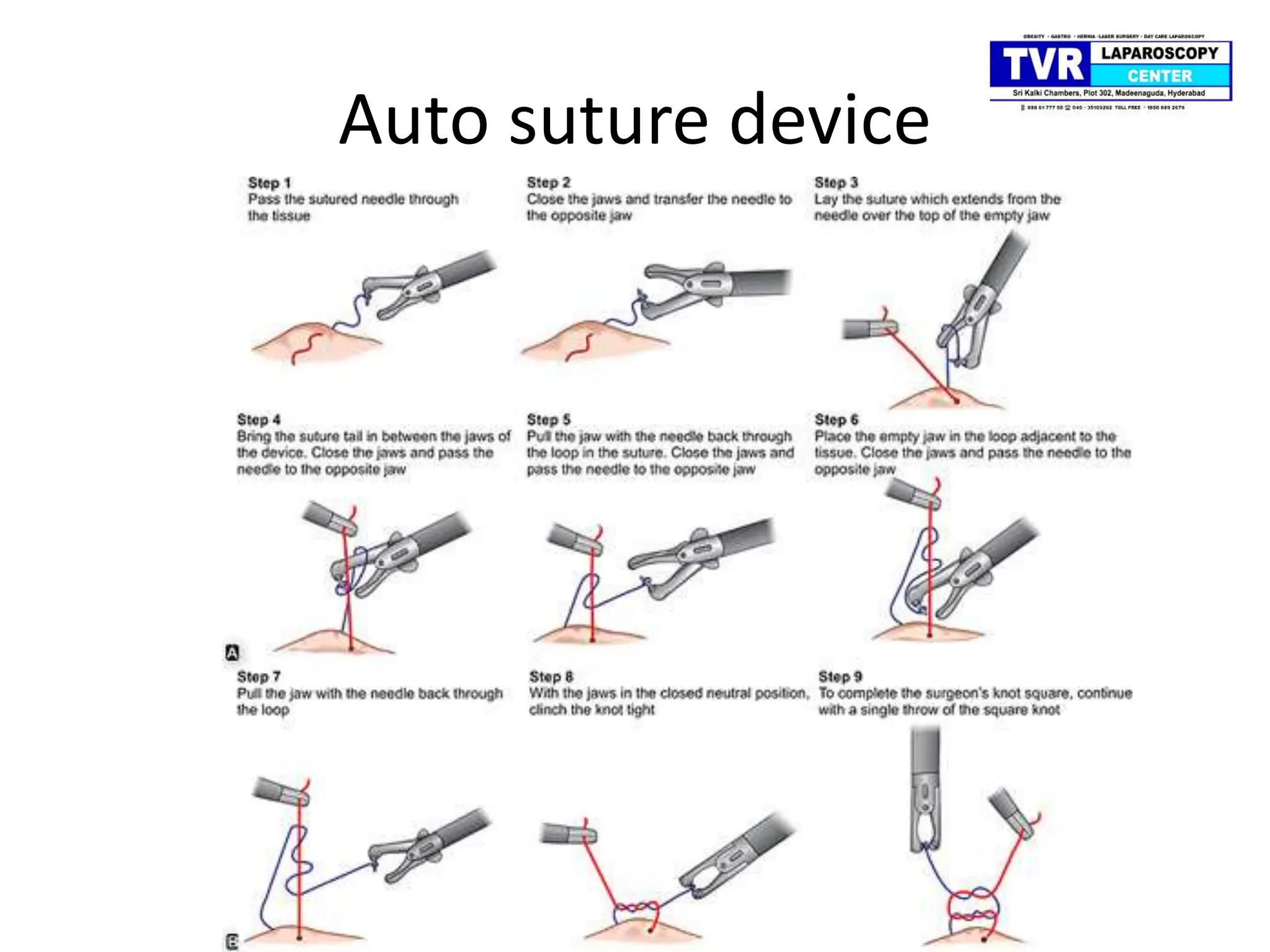 How to master in Laparoscopic SuturingDRTVR.pptx