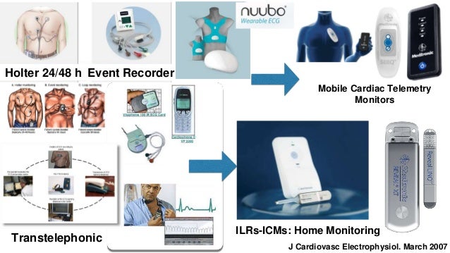 How to monitor patients after Atrial Fibrillation Ablation