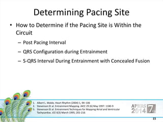 How to perform and interpret entrainment pacing Basics | PPTX