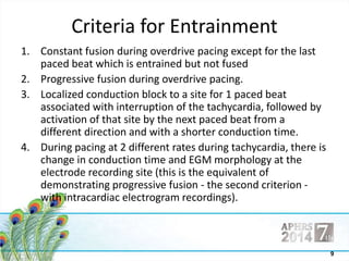 How to perform and interpret entrainment pacing Basics | PPTX