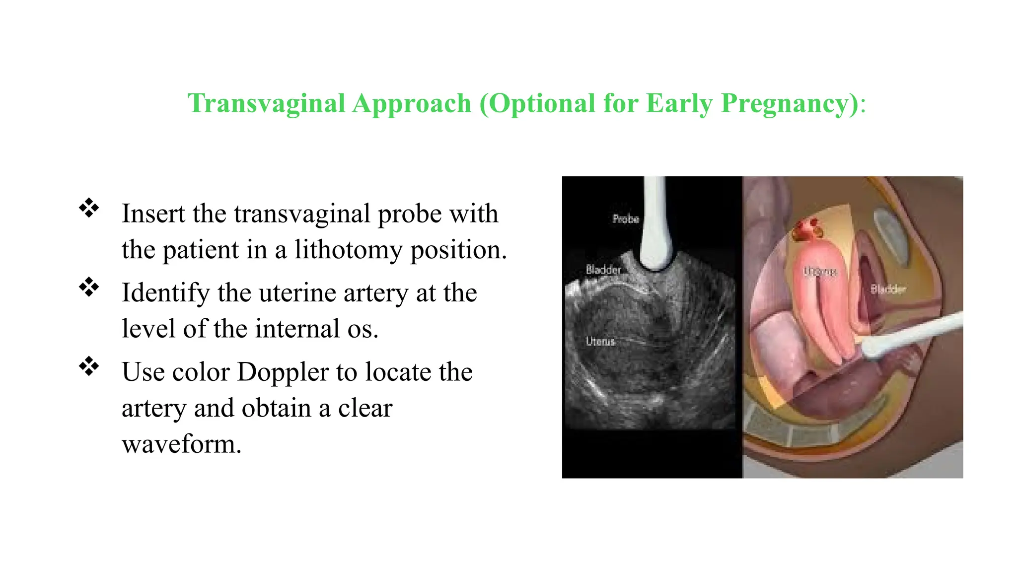 HOW TO PERFORM AND INTERPRET UTERINE ARTERY DOPPLER copy.pptx